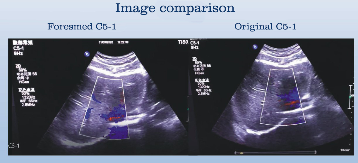 PHILIPS C5-1 Ultrasound probe after repaired performance