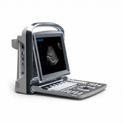 CHISON ECO 1 Portable Ultrasound Machine